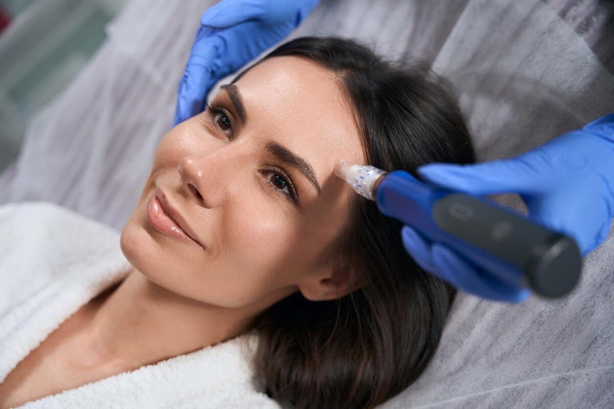 Exploring the Benefits of Microneedling at LUMA